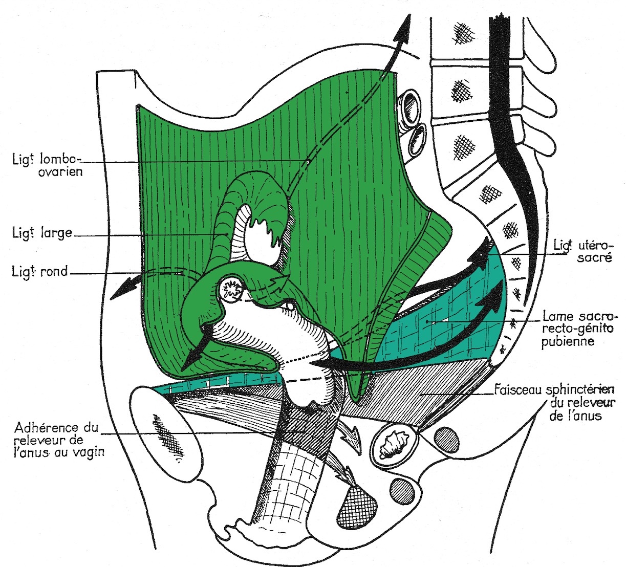 Endométriose, aspect viscéral – Ostéopathe à Paris